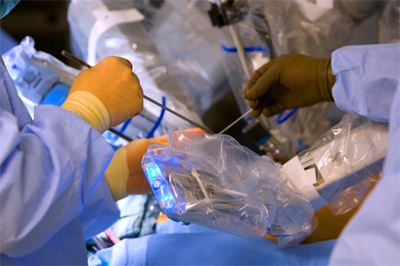 Robotic Laparoscopy Atlanta - Reduced Pain & Fast Recovery